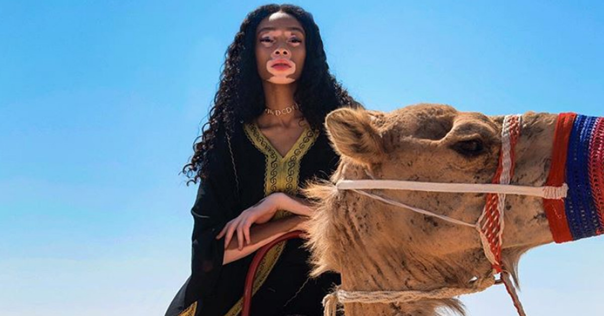 Top model Winnie Harlow is enjoying her time in Dubai